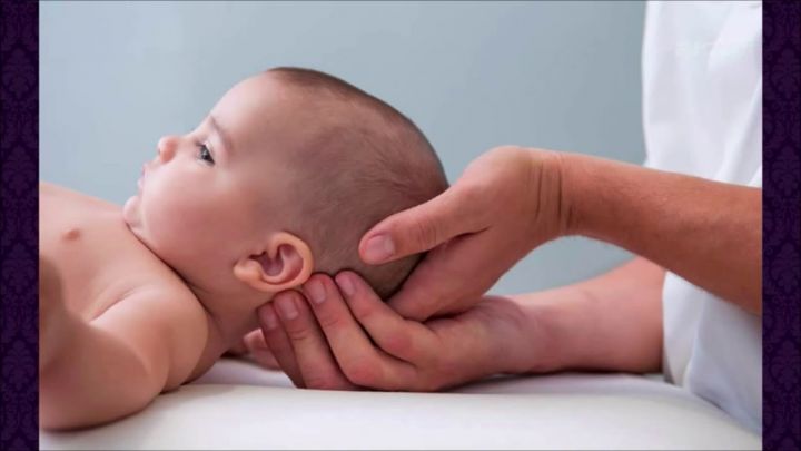 TORCICOLO DO RECÉM-NASCIDO | Osteopata Dr. Daniel Valpaços